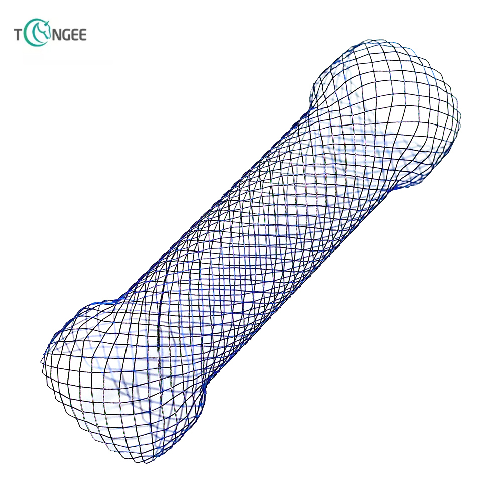 What is a fully covered esophageal SEMS? What is a fully covered esophageal SEMS?